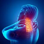 Bulging Disks in the Neck: Symptoms, Causes & Treatment | Dr. Robinson